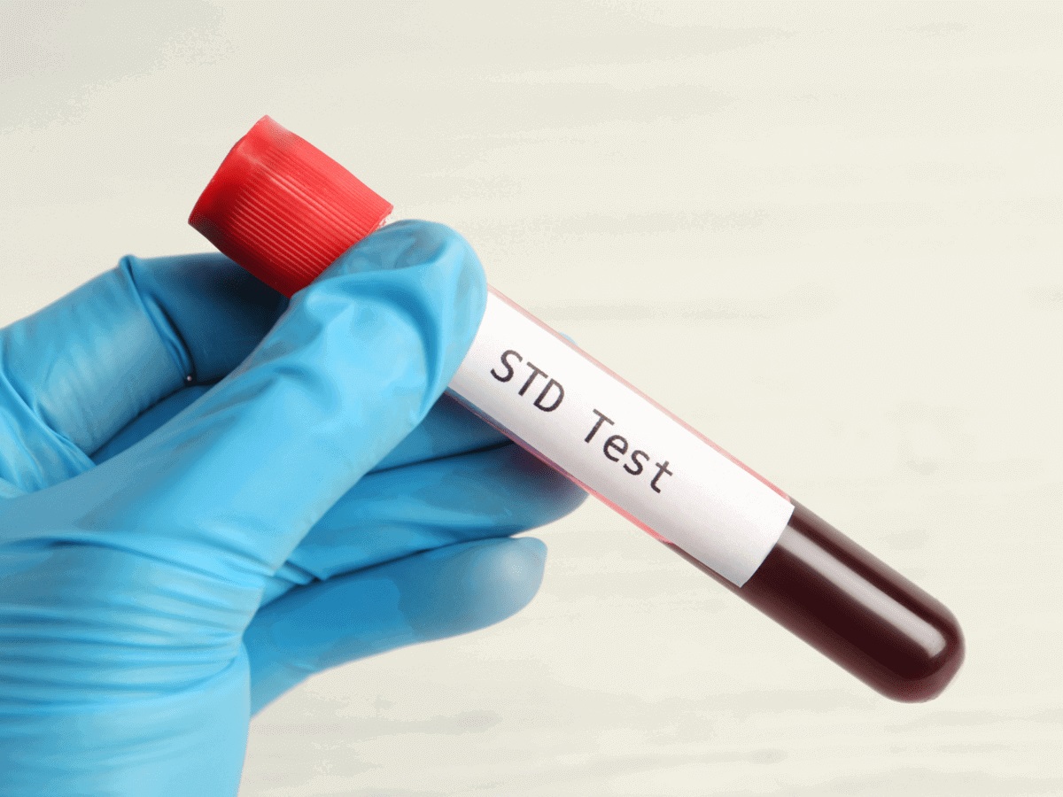 No Stigma, Just Care: The Significance of Routine STD Testing - Vibe ...